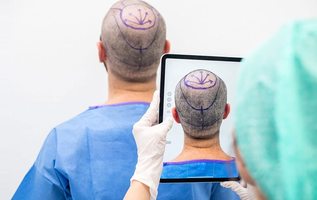 Fue Plus – Tursium Health Tourism Agency