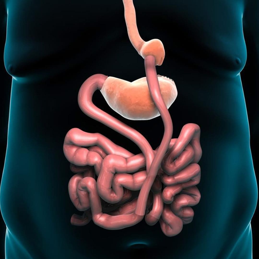 Obesity Surgery / Bariatric Surgery – Tursium Health Tourism Agency