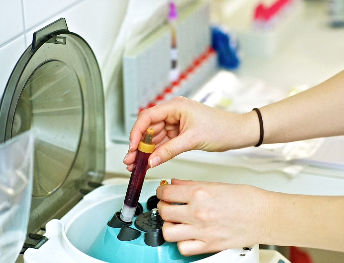 Hematology – Tursium Health Tourism Agency